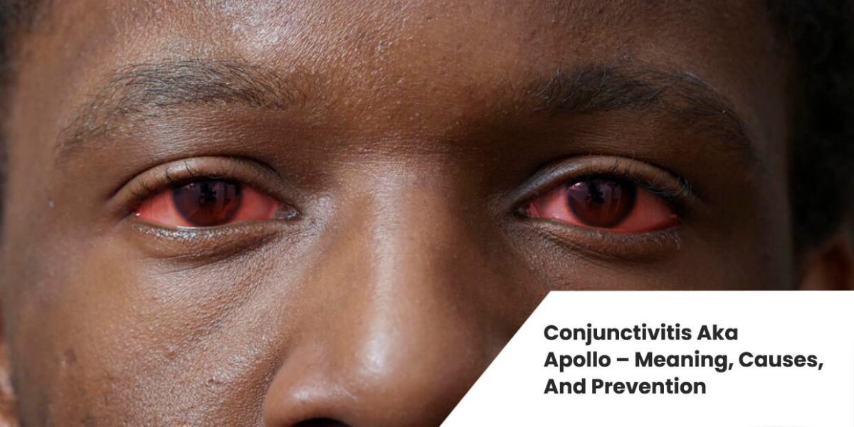 Conjunctivitis Aka Apollo – Meaning, Causes, And Prevention - Skipper EyeQ